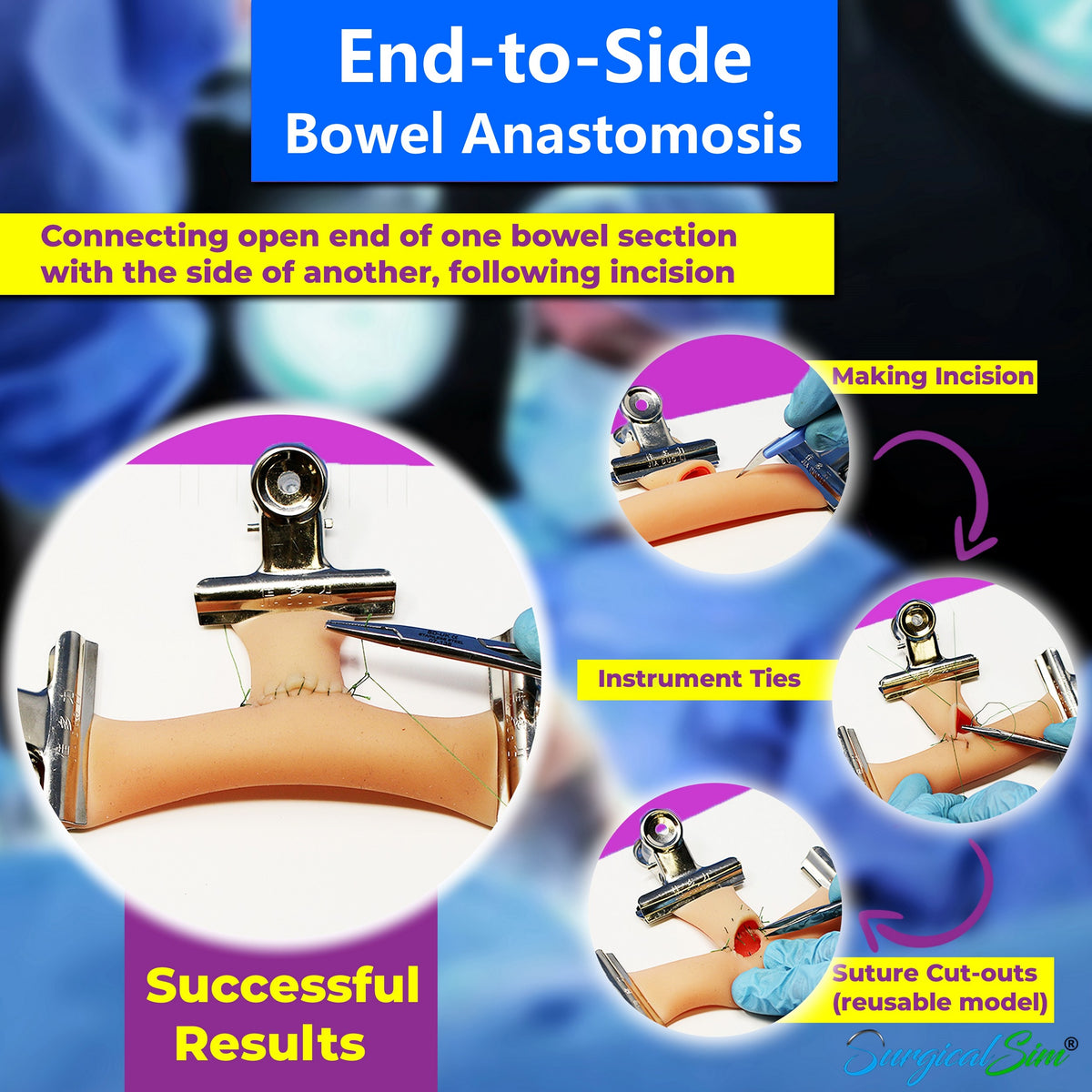 Bowel Anastomosis Training Kit Practice End to Side with 30mm Diameter ...